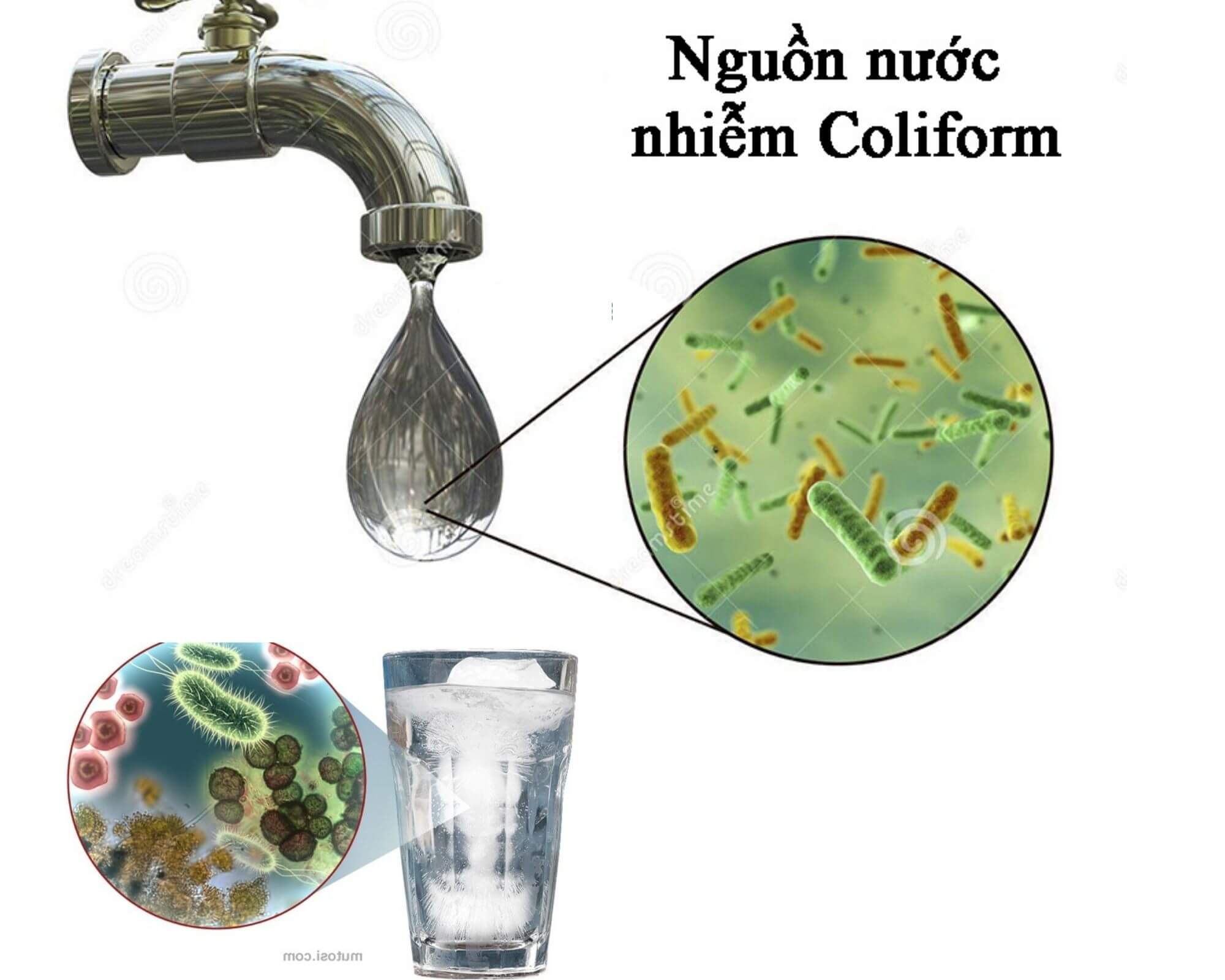 Coliform là gì? Những dấu hiệu cho thấy nước nhà bạn bị nhiễm khuẩn ...